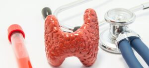 Kalcitonin - Millenium Medic - Slavija, Vračar, Beograd